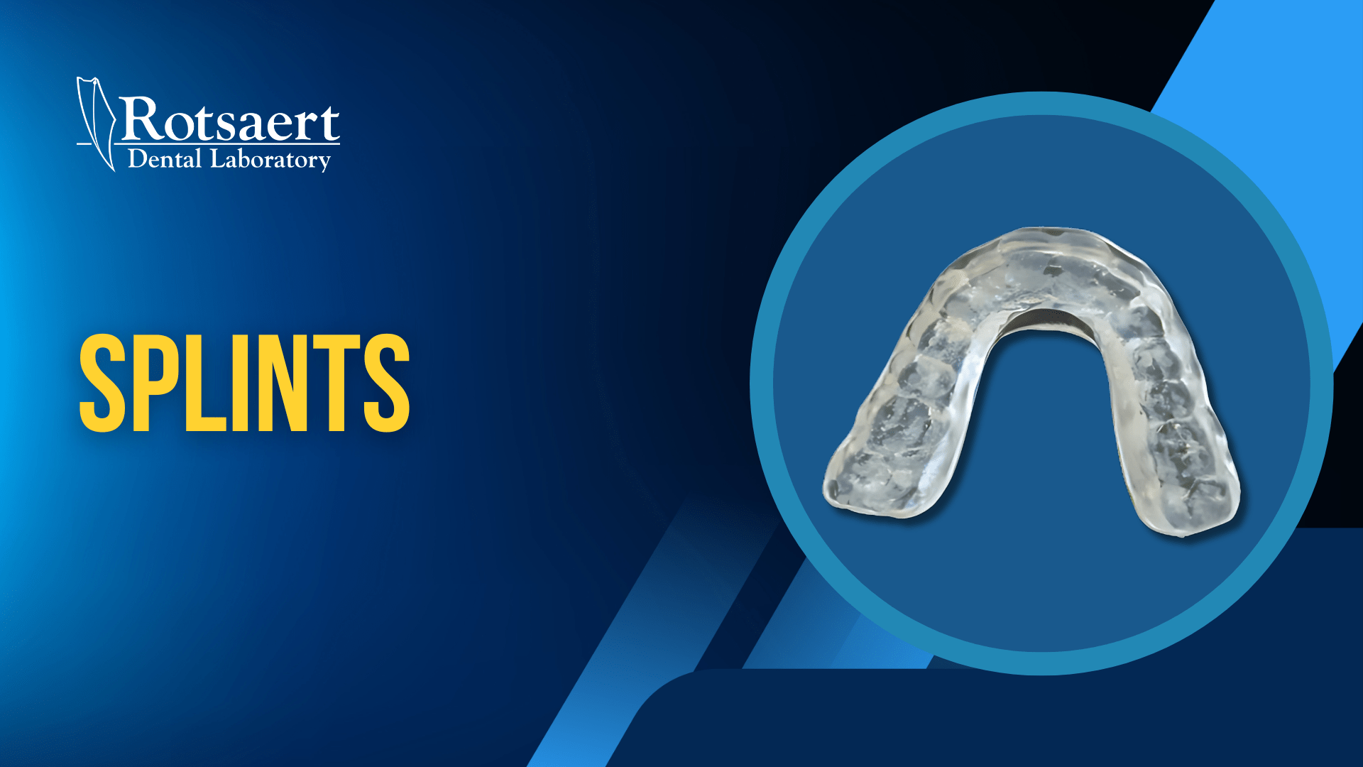 Splints by Rotsaert Dental Laboratory